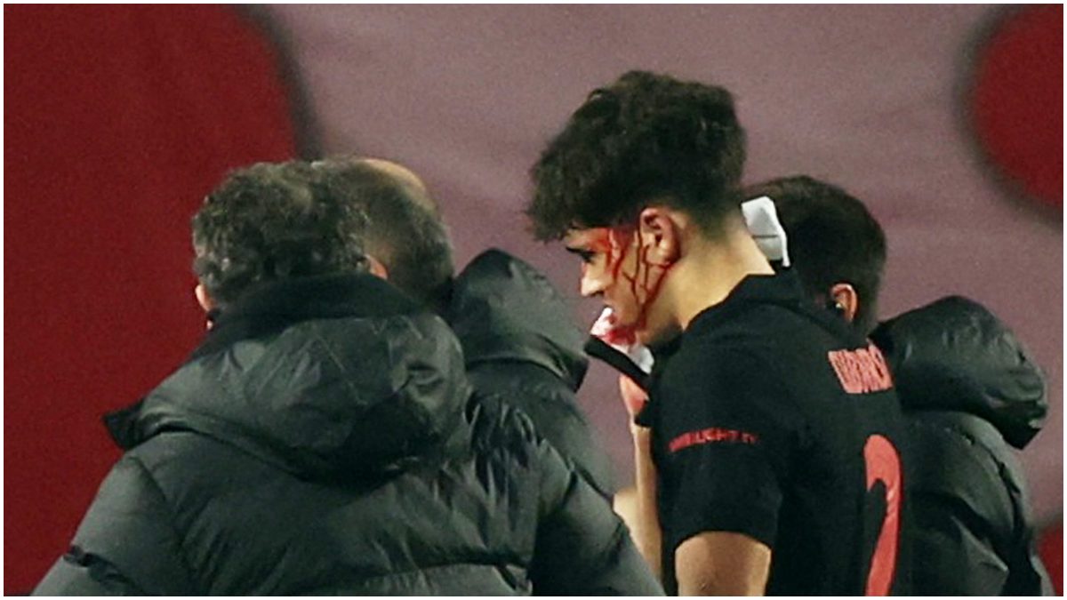 Lesión de Cubarsí: Imágenes y videos del momento de la aparatosa jugada ...